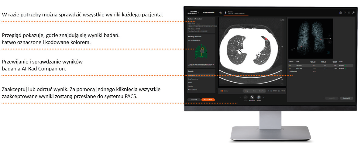 AI-Rad Companion Siemens Healthineers – sztuczna inteligencja w służbie ...
